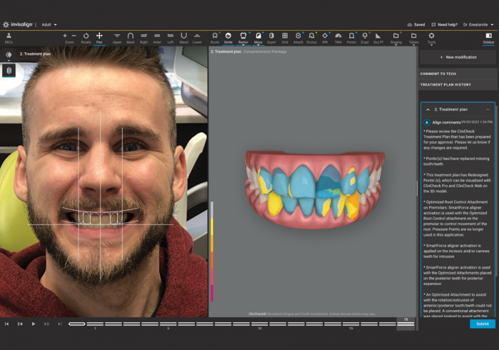 Align launches ‘Invisalign Smile Architect’ - Scottish Dental magazine ...