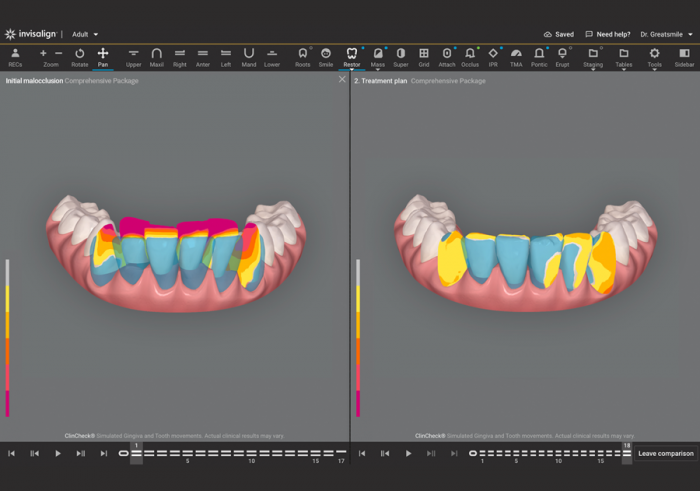 Align launches ‘Invisalign Smile Architect’ - Scottish Dental magazine ...